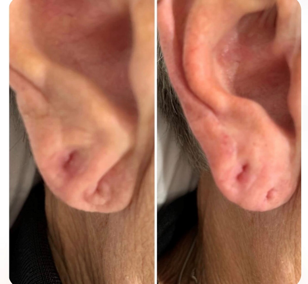 Before & After - Cosmetic Face Clinics